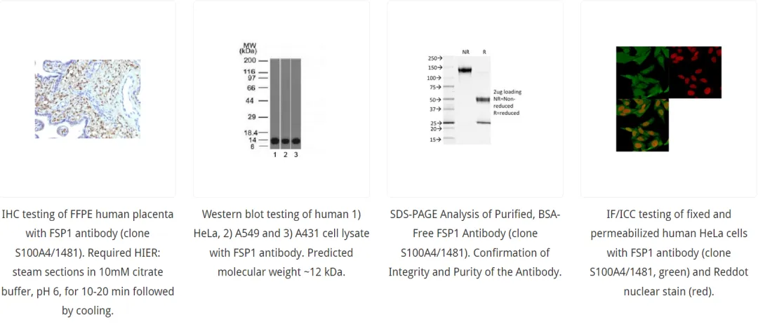 【Biorbyt科研专题】成纤维细胞标志物