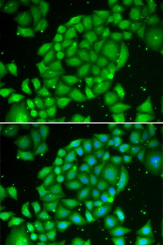 TCL1A Antibody, Unconjugated, Rabbit, Polyclonal | BIOZOL