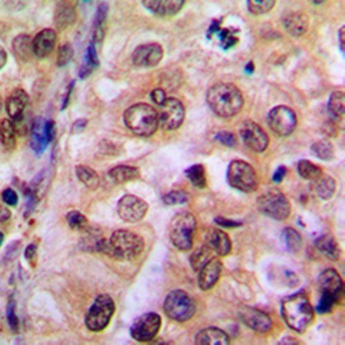 IKBKG antibody | Biorbyt