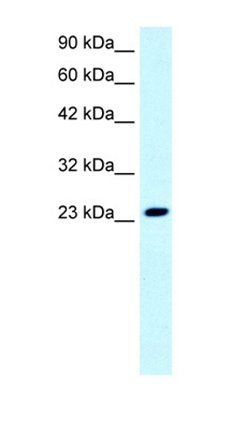 MEAF6 antibody | Biorbyt